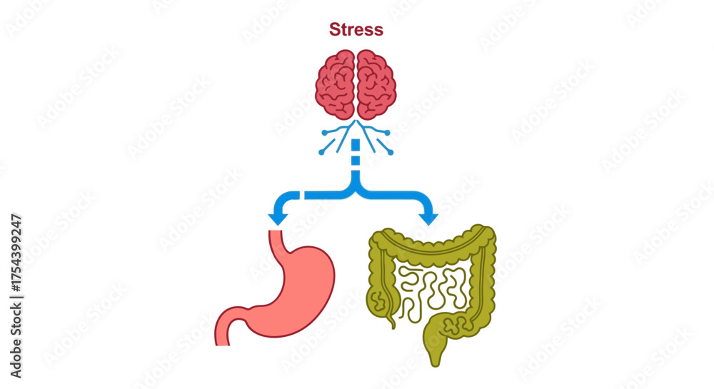 Understanding stress and its impact on digestion, showing the ...