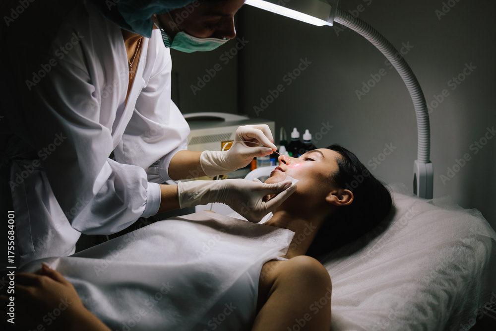 Photo Stock Laser dermatologic treatment for nevus and mole removal ...