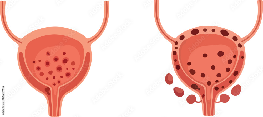 Urinary System Bladder Icon - Anatomy Vector Design-medical poster ...