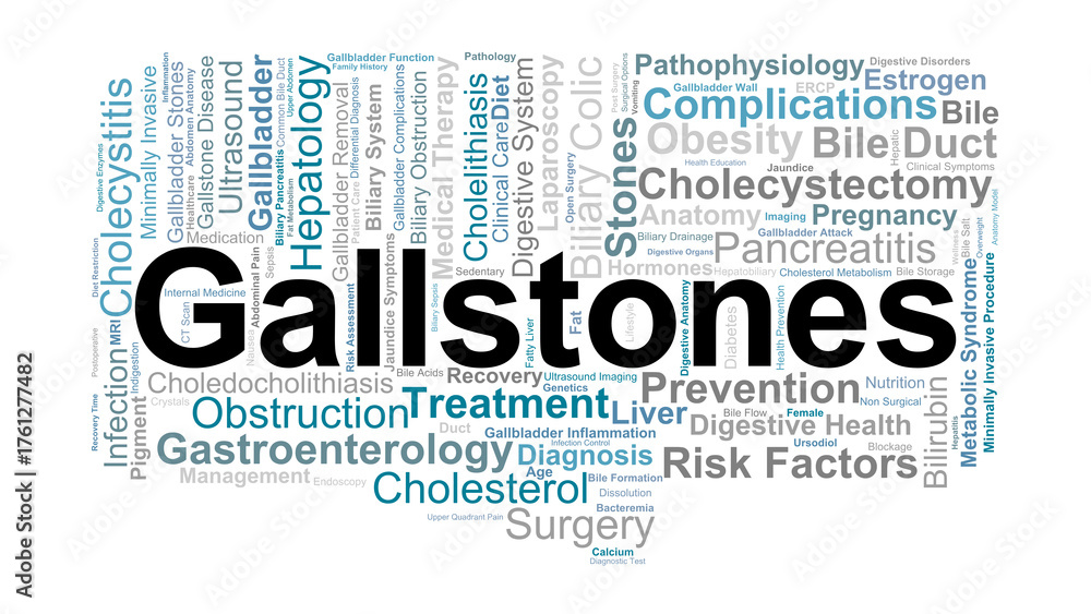 Gallstones Word Cloud. Key Medical Terms On Gallbladder Disease, Bile ...