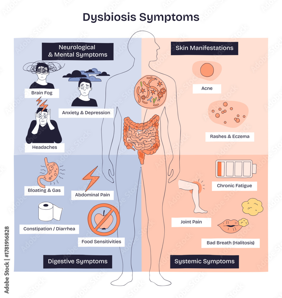Image vectorielle Stock Dysbiosis symptoms mapped, gut microbiome ...
