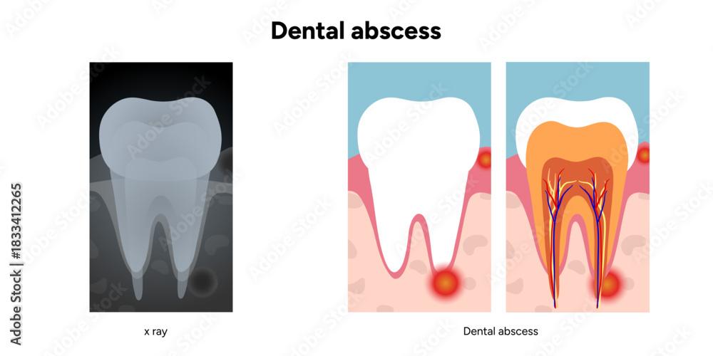 Clear, minimal medical diagram showing the basic anatomy of tooth ...