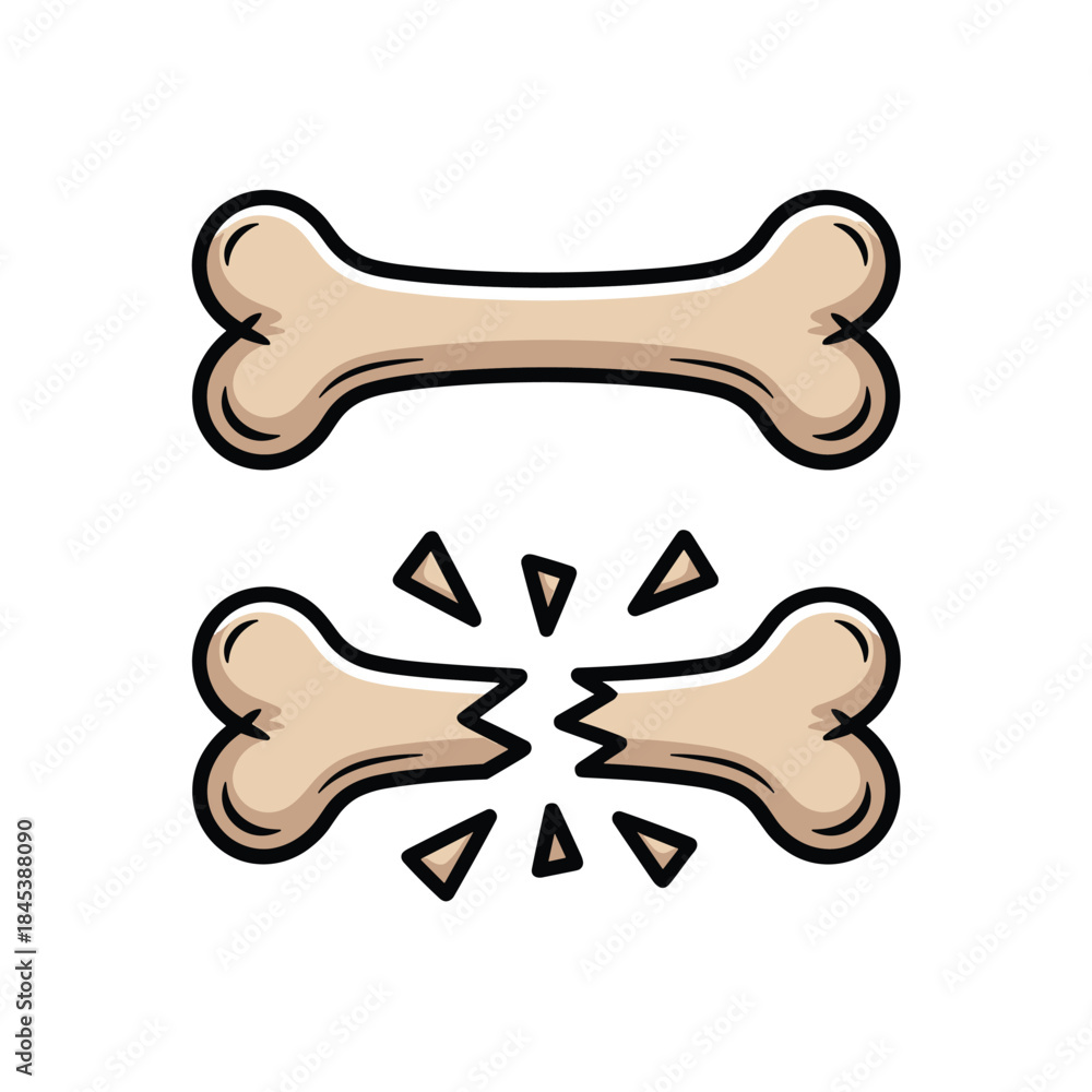 Broken and Intact Bone Cartoon Vector Illustration. Fractured Bone ...