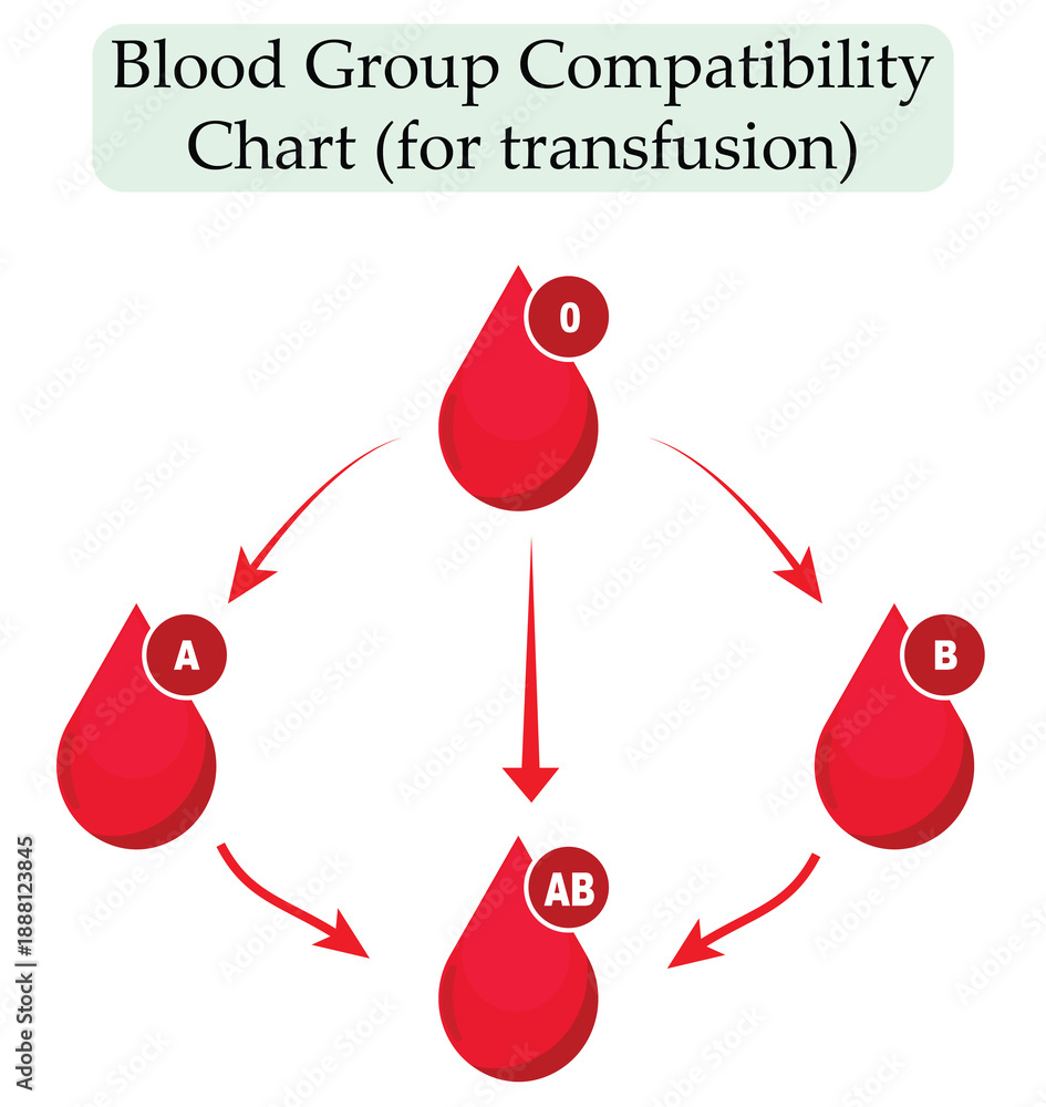 Blood Type Compatibility Chart for Medical Education, Healthcare ...
