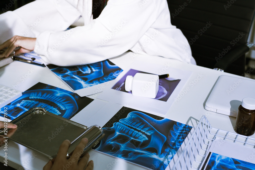Photo Stock Doctor Explaining X-Ray Results to a Patient Using a ...