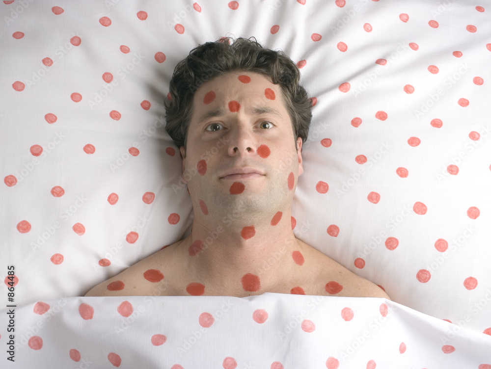 man with red spots on face and body Stock Photo | Adobe Stock