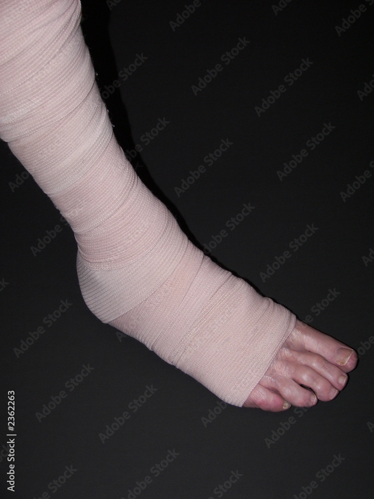 man with sprained ankle Stock Photo | Adobe Stock