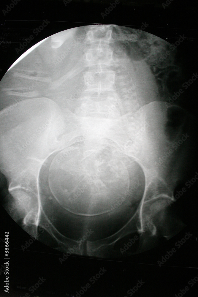 X-ray of pregnant woman Stock Photo | Adobe Stock