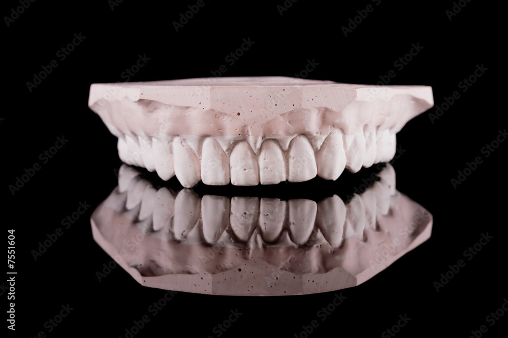 gypsum model of a human teeth on black background Stock Photo | Adobe Stock