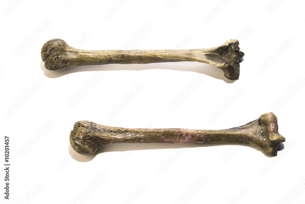 two human leg bones. Stock Photo | Adobe Stock