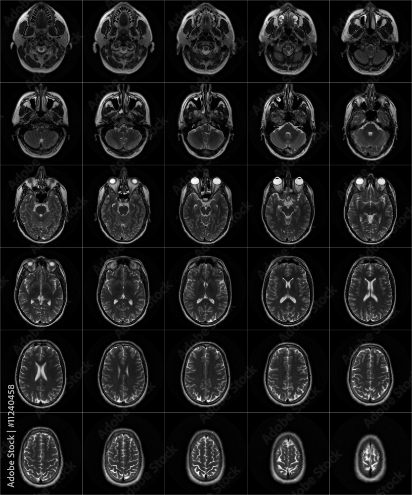 IRM du cerveau - Série 2 Photos | Adobe Stock