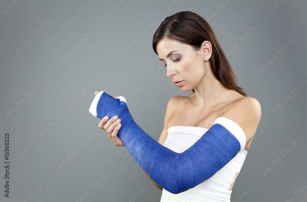 Frau mit Gipsarm Stock Photo | Adobe Stock