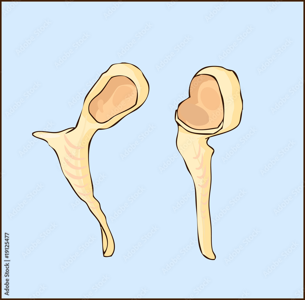 Malleus ear bone medical illustration, skeletal Anatomy, ear bo Stock ...