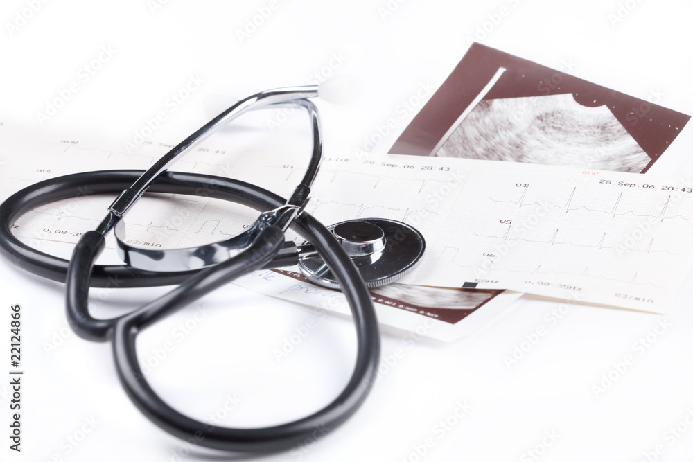 Foto de A stethoscope on the top of the EKG chart and USG picture do ...
