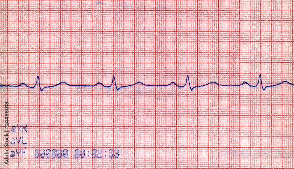 cardiovascular doppler diagram, cardio patient, clinic health care ...