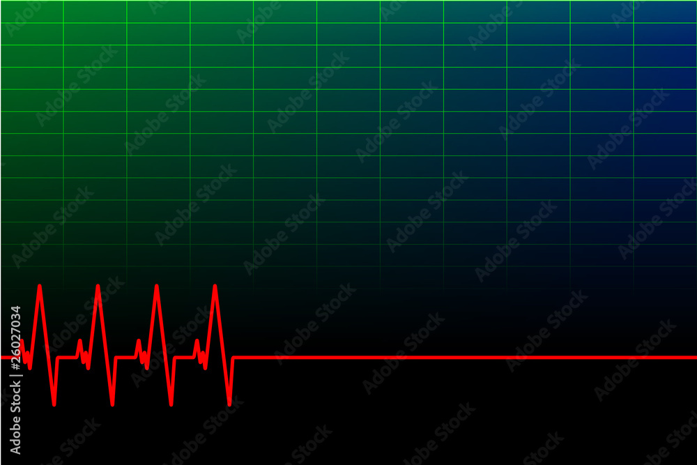 vector ECG background/business card Stock Vector | Adobe Stock