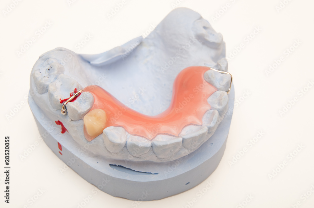 Gebiss - Mandible model Stock Photo | Adobe Stock