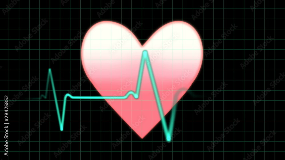 EKG heartbeat monitor, animation Stock Video | Adobe Stock
