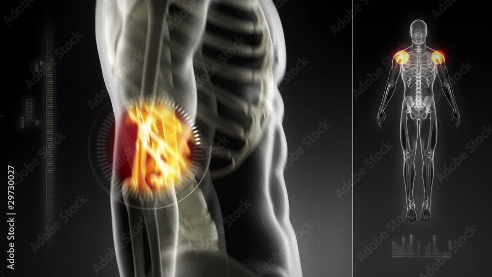 Human joints concept – walking man with visible joints Stock Video ...