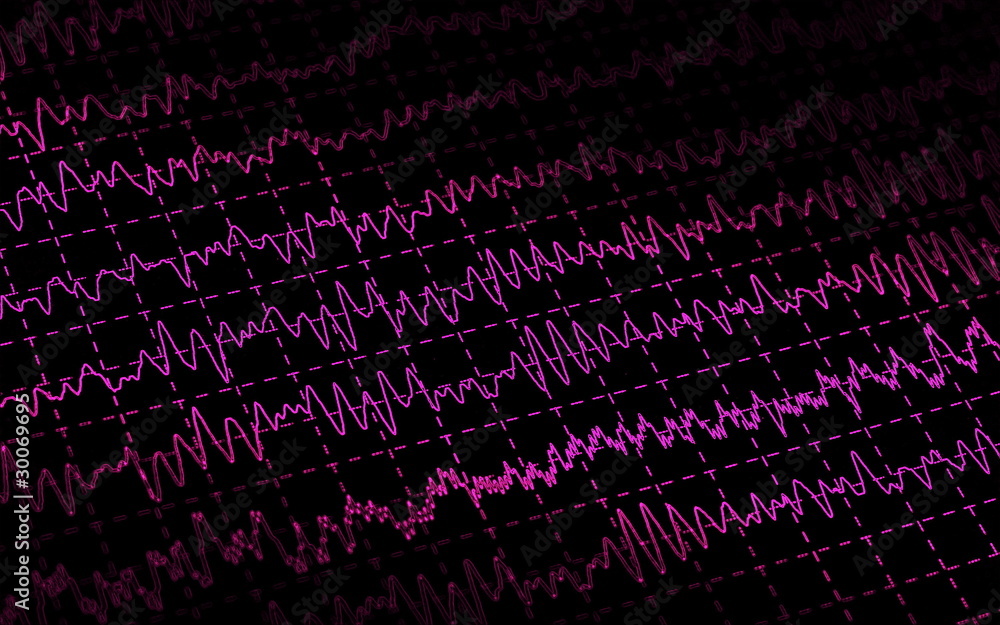 brain wave EEG isolated on black background Stock Photo | Adobe Stock