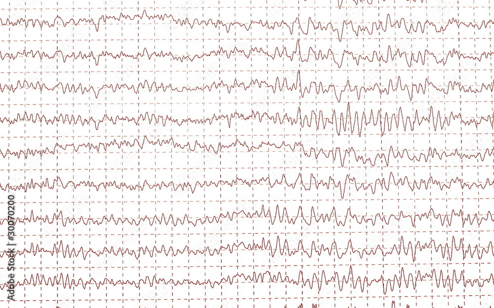 electroencephalogramme (EEG) Stock Photo | Adobe Stock