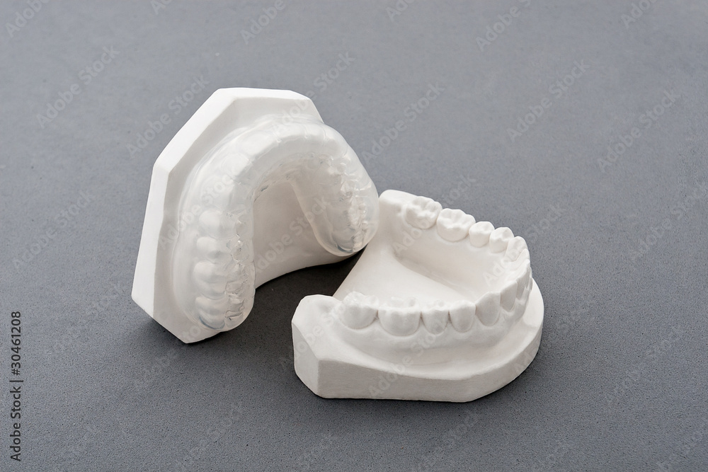 Dental plaster mold Stock Photo | Adobe Stock
