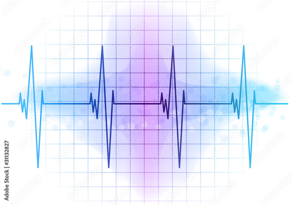 ekg diagram Stock Vector | Adobe Stock