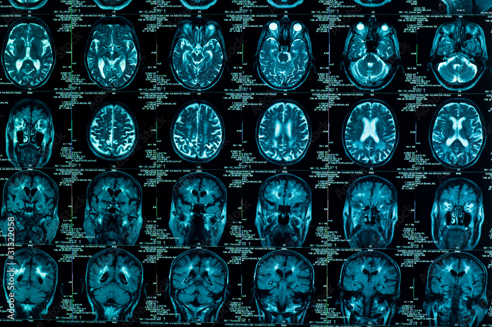 sharp ct scan of the human brain Stock Photo | Adobe Stock