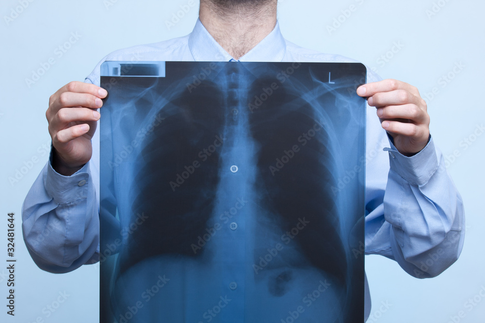 Chest x-ray Stock Photo | Adobe Stock