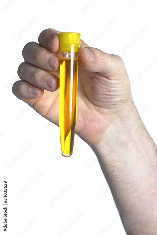 Urine test Stock Photo | Adobe Stock