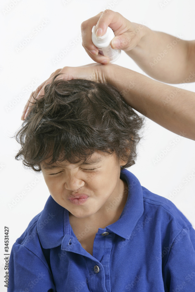 Spray anti-poux sur un jeune garçon foto de Stock | Adobe Stock