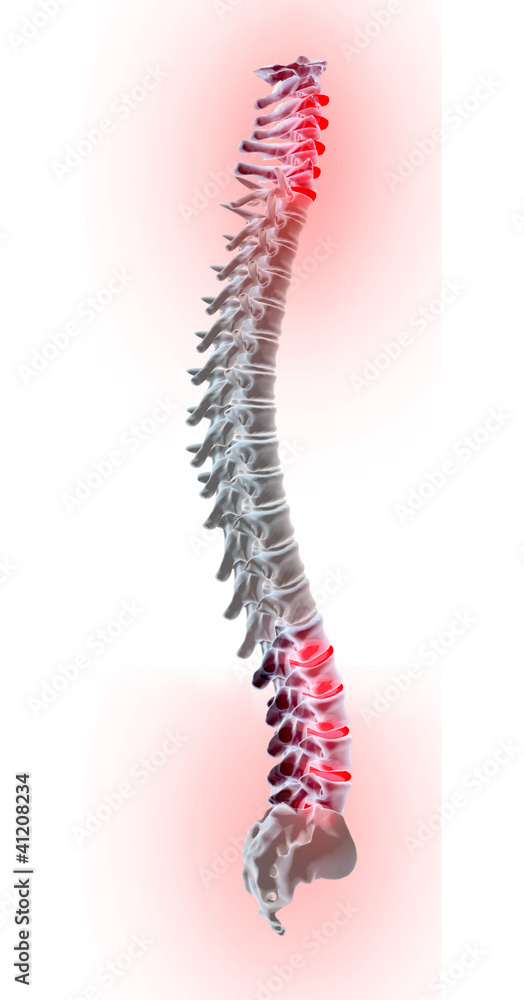 wirbelsäule Halswirbel lendenwirbel LWS HWS schmerz weiss Stock ...