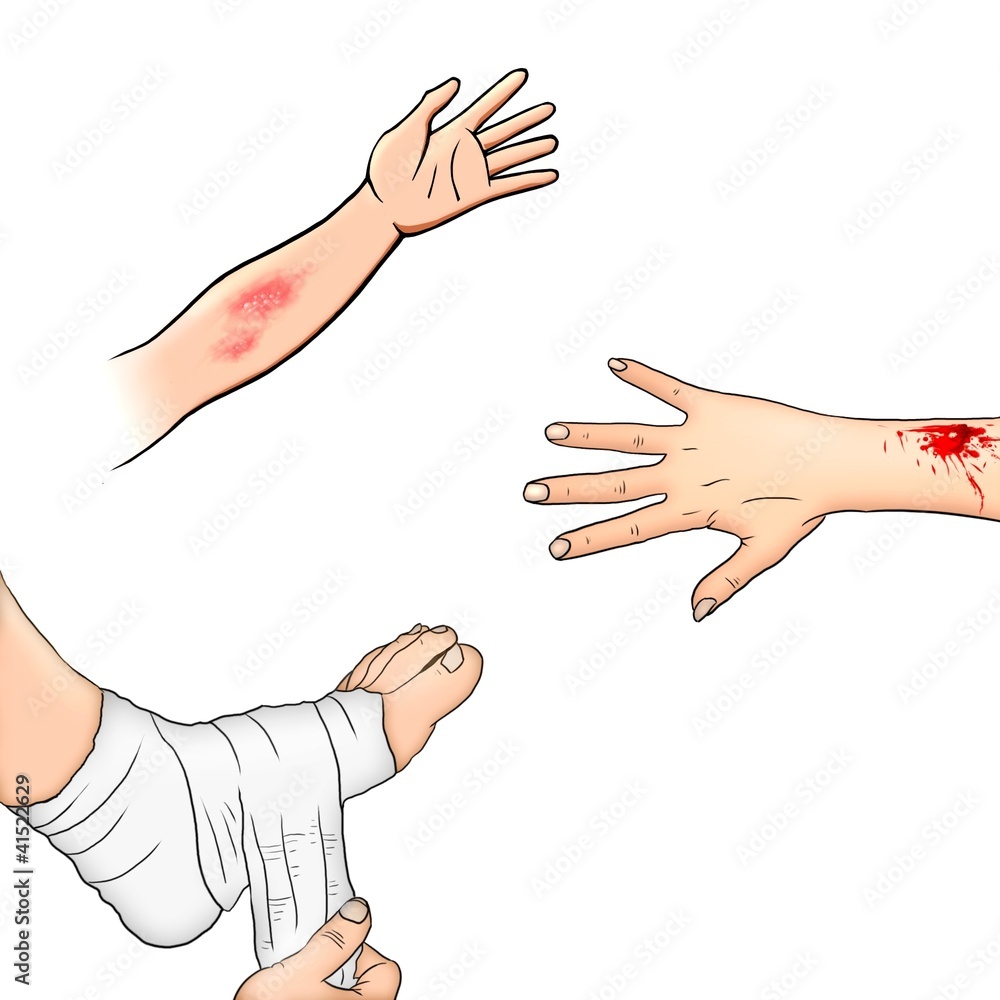 first aid injuries illustration Stock Illustration | Adobe Stock