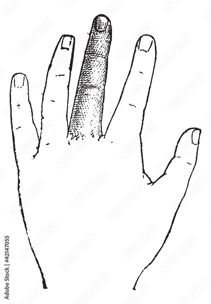 Human Middle Finger, vintage engraving Stock Vector | Adobe Stock