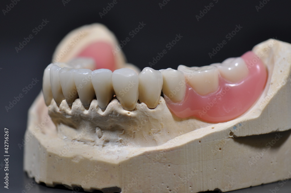 Zahnprothese Stock Photo | Adobe Stock