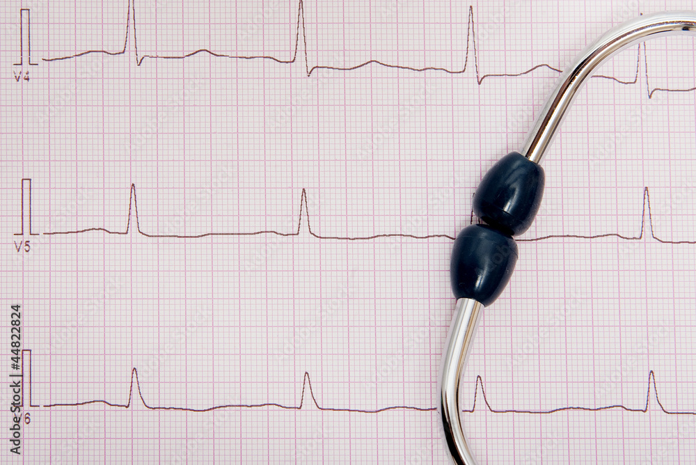 ECG chart and stethoscope Stock Photo | Adobe Stock
