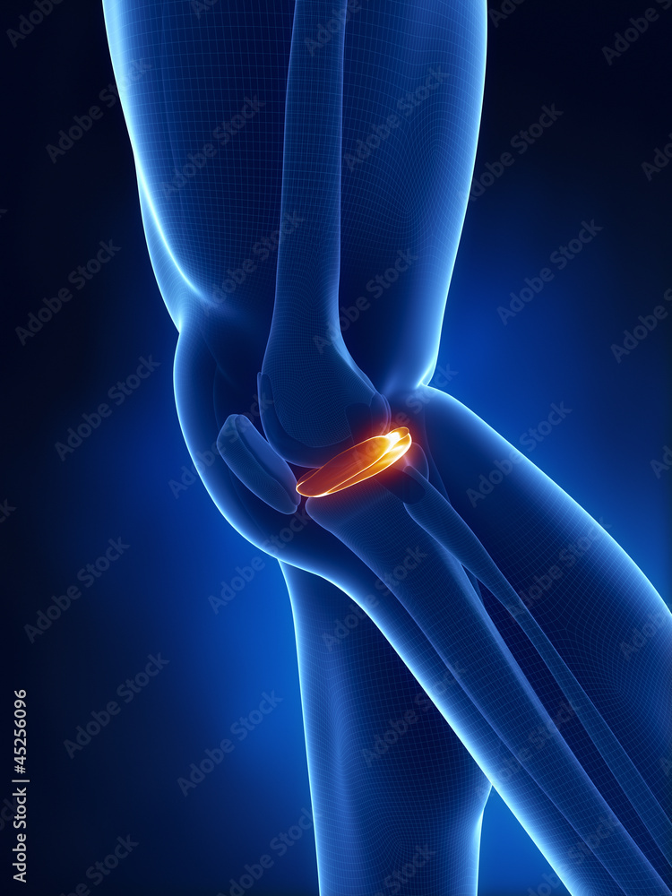 Knee meniscus anatomy lateral view Stock Illustration | Adobe Stock