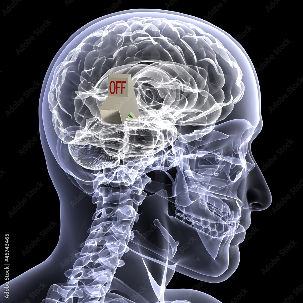 Skeleton X-Ray - Brain Off Stock Illustration | Adobe Stock