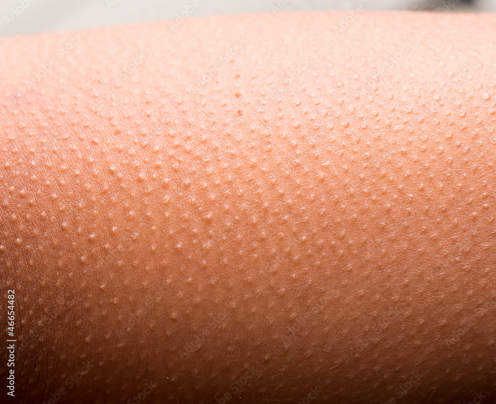 horripilation Stock Photo | Adobe Stock