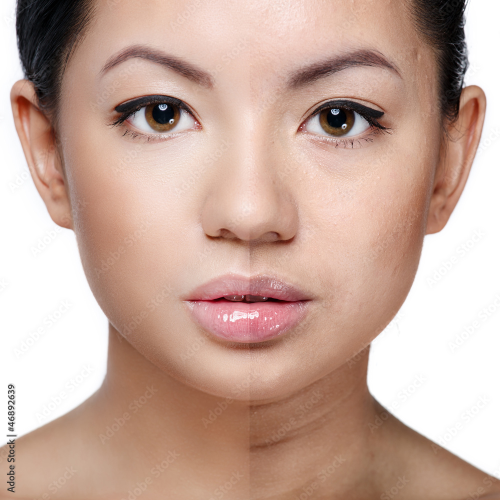 beautiful healthy versus unhealthy skin complexion Stock Photo | Adobe ...
