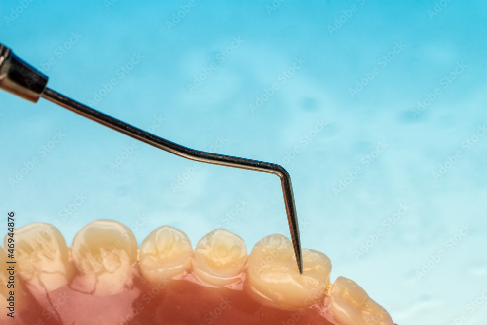 Zahnarztsonde Untersuchung Prothese Stock-Foto | Adobe Stock