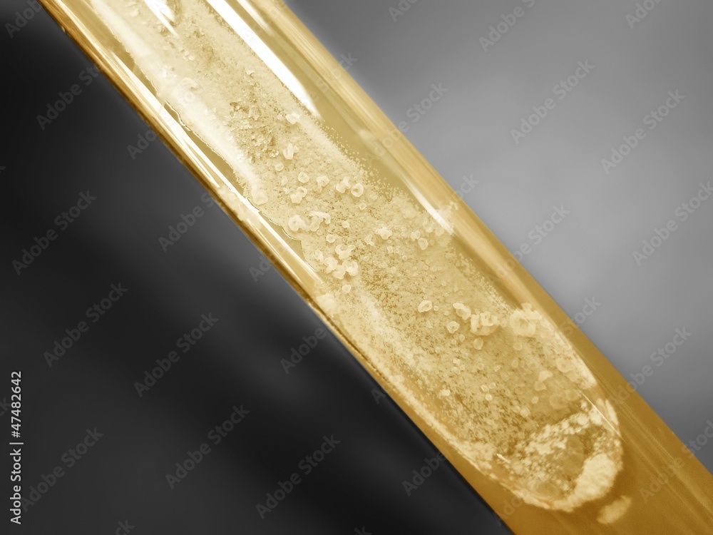 Bacterial pathogen / bacteria / growth in an agar slant in a lab Stock ...