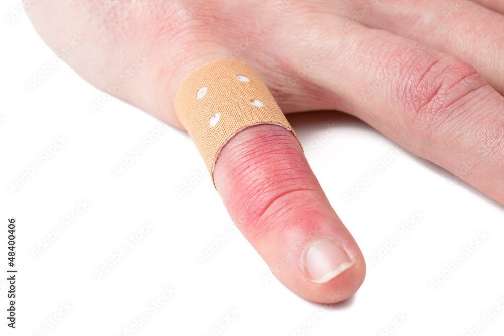 Wunde am Finger Stock-Foto | Adobe Stock