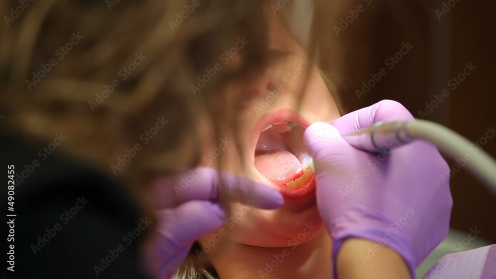 Woman dentist drilling tooth of little girl patient Stock Video | Adobe ...
