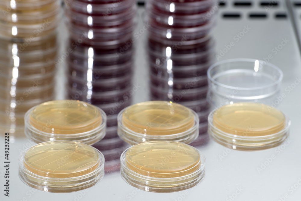 Placas rodac para cultivo de bacterias fondo Stock Photo | Adobe Stock