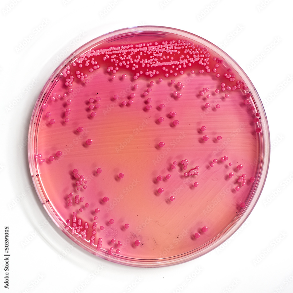 agar plate with microorganisms in an hospital laboratory Stock Photo ...