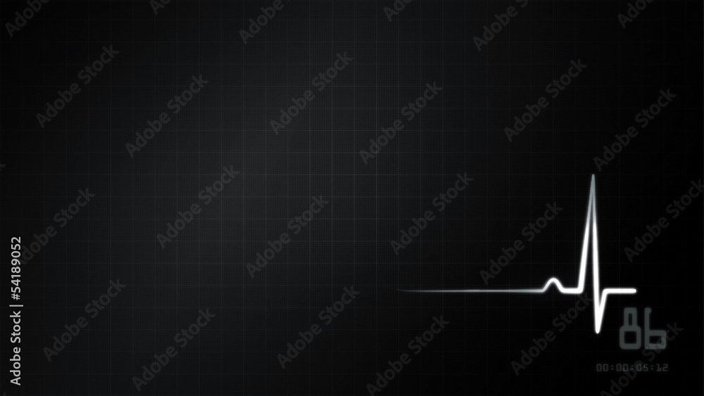 black EKG monitor background Stock Illustration | Adobe Stock