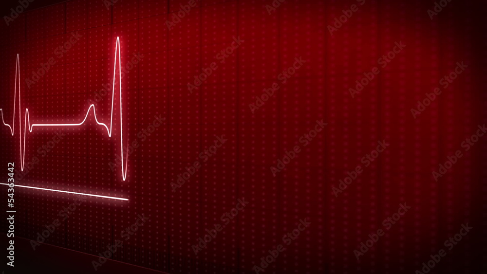 EKG electrocardiogram pulse trace Stock Video | Adobe Stock