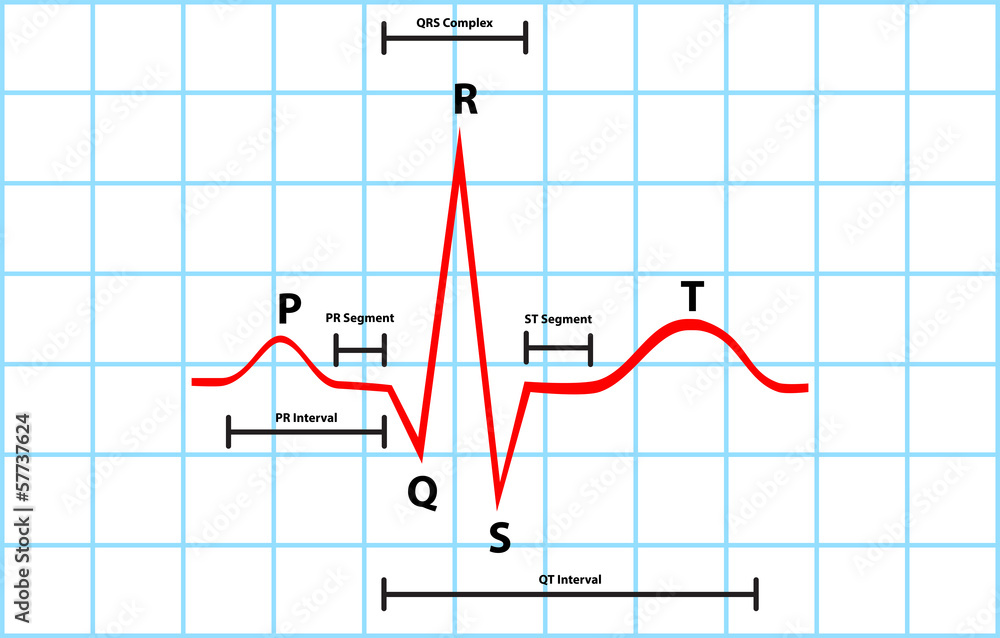Normal Atrial And Ventricular Depolarization Description Stock Vector ...