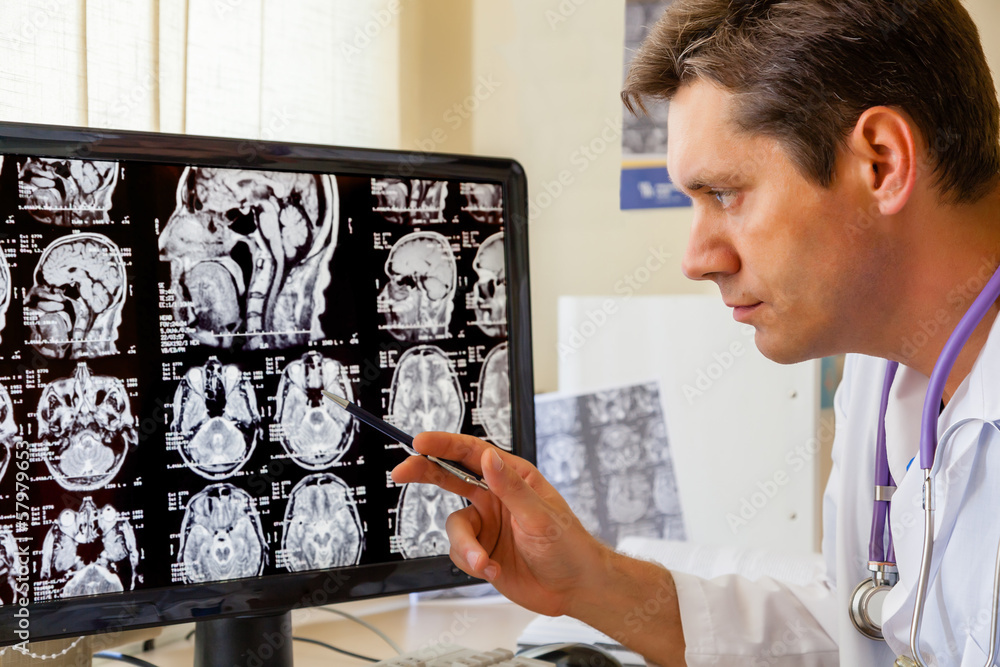 Doctor examining an MRI scan of the Brain Foto Stok | Adobe Stock